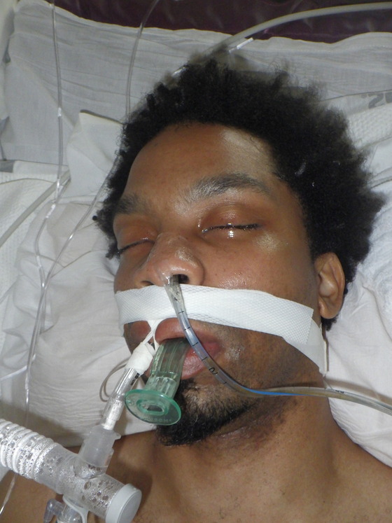 LA County Seeks Help Identifying John Doe Patient - MyNewsLA.com