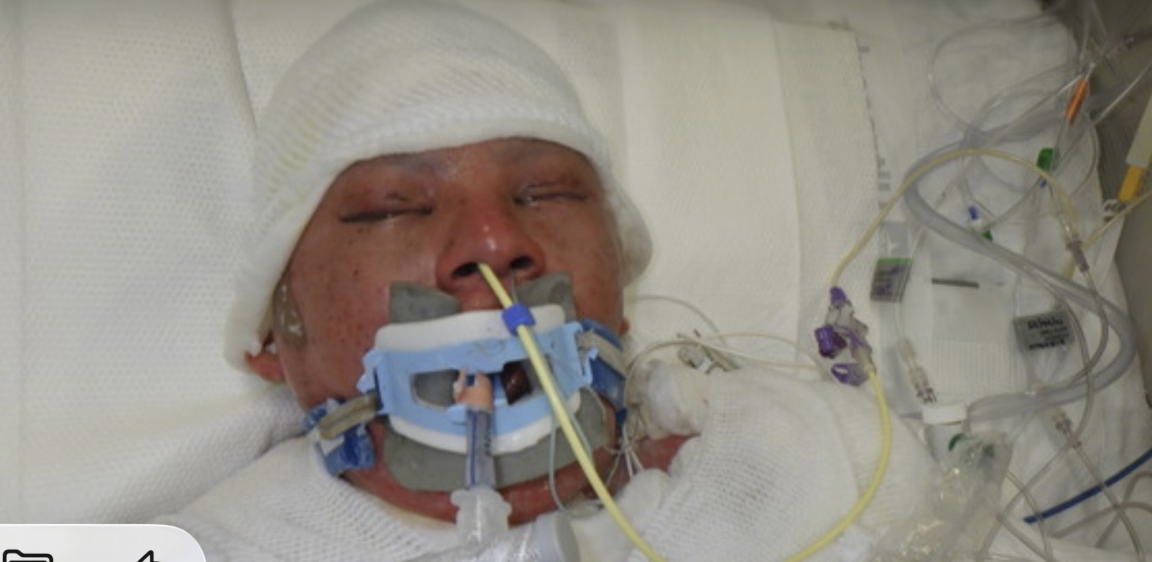 Social Workers at LA General Ask for Help IDing John Doe Patient ...