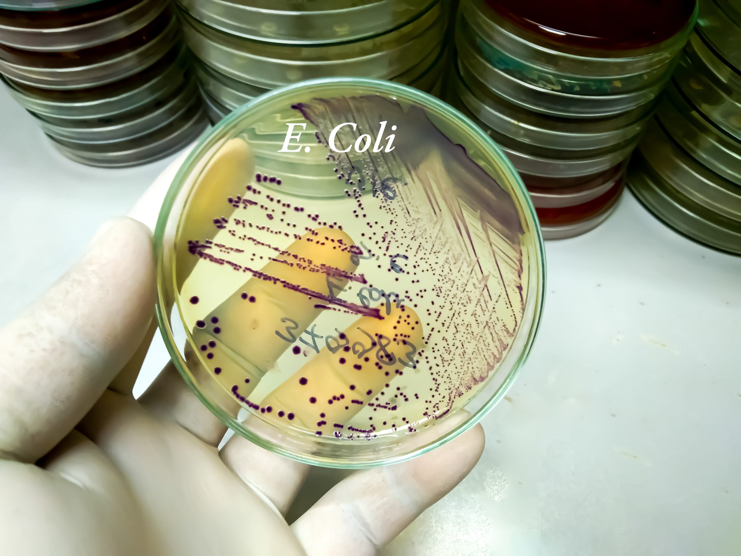E.coli Outbreak Causes Koreatown Boil-Water Advisory - MyNewsLA.com